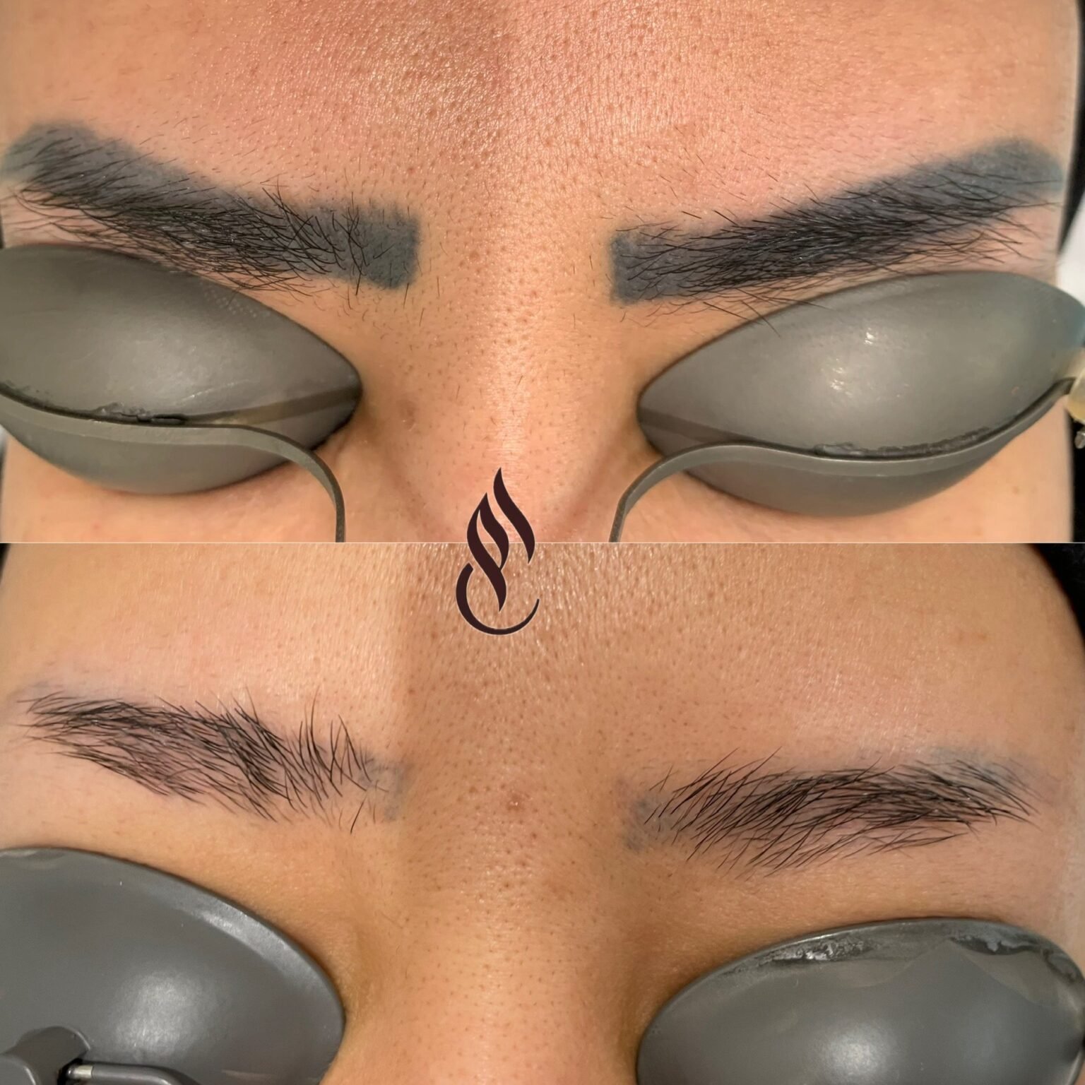 Professional Laser Clinic